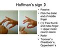 Cervical Special Tests Flashcards Quizlet