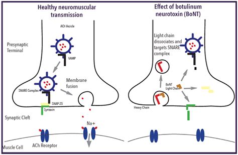 Annals Of B Pod Infantile Botulism — Taming The Sru