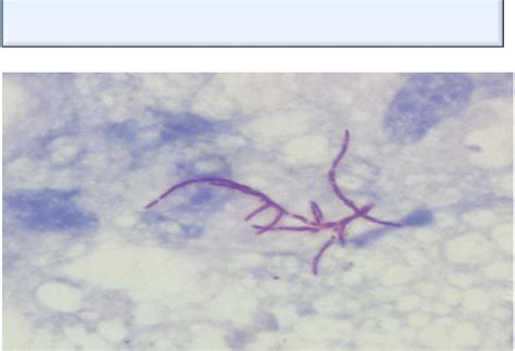 Rus Trom Sud Cutaneous Adscess Was Received Tor Gram Stain