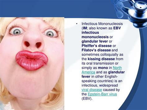 Ppt Infectious Mononucleosis Powerpoint Presentation Free Download