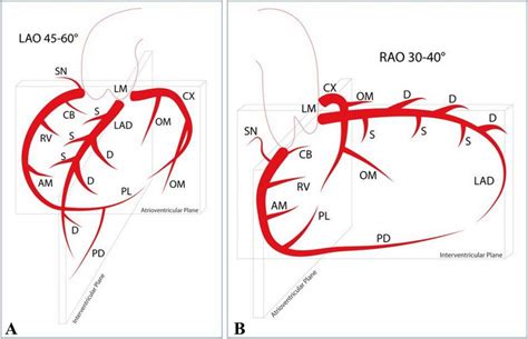 Basic Principles Of Invasive Coronary Angiography The Coronary Tree
