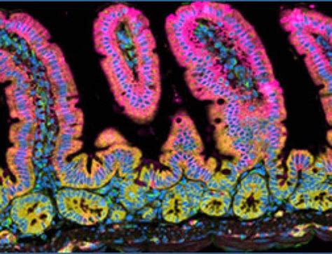 Reducing Small Rna Sequencing Biases Rna Seq Blog