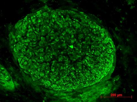 Ethics And Reprogramming Ethical Questions After The Discovery Of Ips