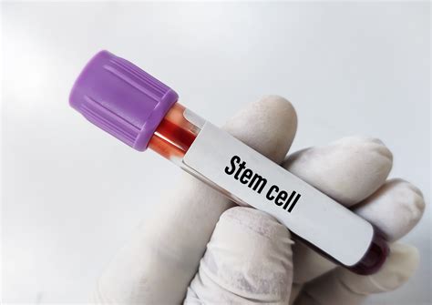 Memahami Terapi Stem Cell Apa Itu Dan Bagaimana Cara Kerjanya Jakarta Stemcell Centre
