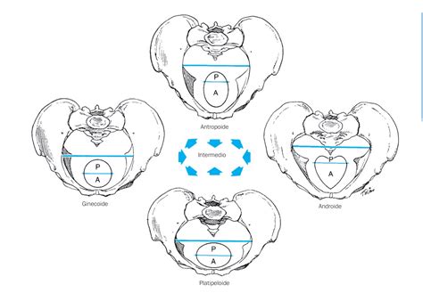 Clasificación Anatómica De La Pelvis Caldwell Moloy Homo Medicus