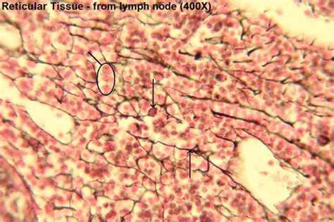 Lymphatic System Flashcards Quizlet