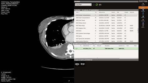 Toltech Sectra Table
