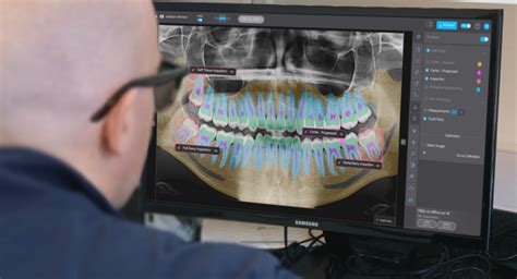 Pearl Press Release Fda Clears Pearls Platform For Ai Assisted