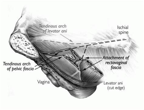 Tendinous Arch Of Pelvic Fascia