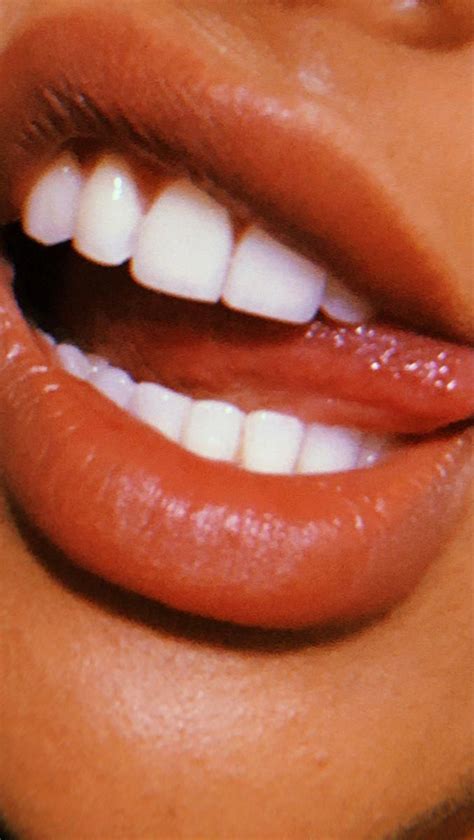 Get Rid Of Cavities And Tooth Decay Artofit