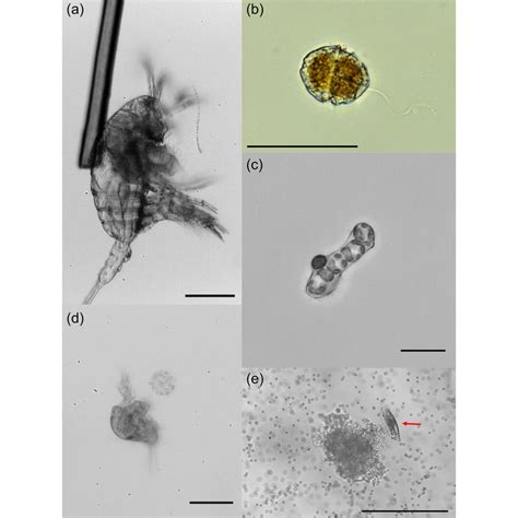 2 Direct Observations Of Plankton Using High And Low Speed Video A