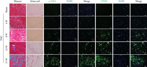 The Construction Of A Transverse Aortic Constriction Tac Model To Download Scientific Diagram
