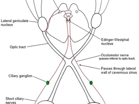Pupil Assessment Scale