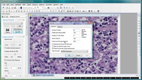 Infinity Analyze Software Auto Exposure Upper Limit Youtube