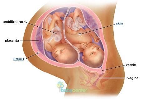 Twin Pregnancy At 36 Weeks Symptoms You Shouldnt Ignore Twins In