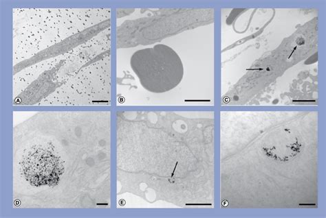 Transmission Electron Micrographs Of Osteogenic Cells Exposed To Either