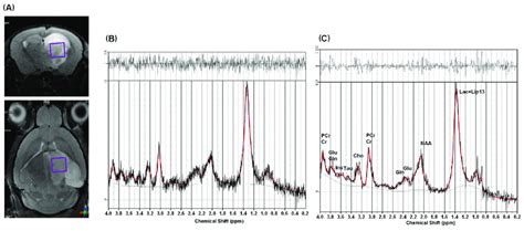 1 H Mrs Data Acquisition And Analysis Results 1 H Mrs Voxel