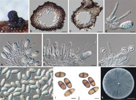 Lasiodiplodia Huangyanensis A Conidioma Formed On Pna B C Section