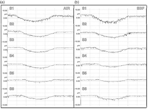 2d Surface Profiles Recorded Using Laser Surface Profilometer Of Worn