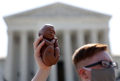 Supreme Court Could Redefine When A Fetus Becomes A Person Upholding