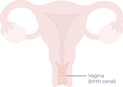 Vaginal Cancer Signs And Symptoms Diagnosis Treatment