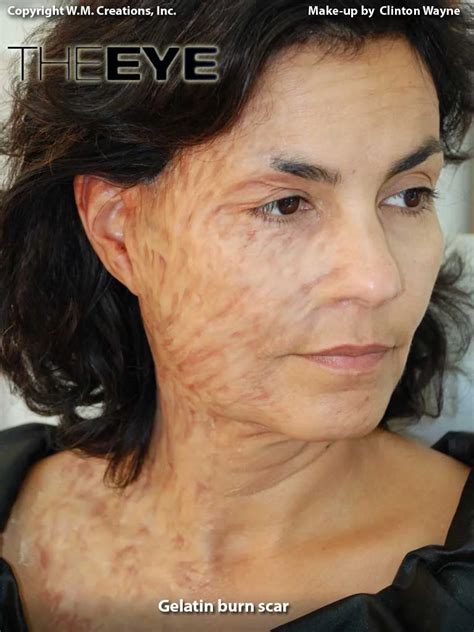 Fake Burn Scar Makeup Saubhaya Makeup