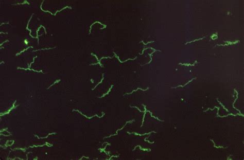 What Is Fluorescent Treponemal Antibody Test At Rory Barbour Blog