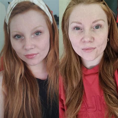 Final Banda Now My Scabs Are Off And Its Been A Couple Of Weeks Im