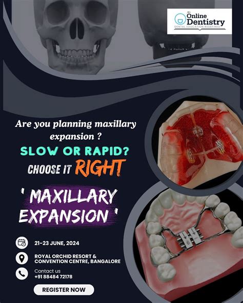 Online Dentistry On Linkedin Growth Modifications With Interceptive