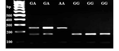 The Electrophoretic Pattern Obtained After Digestion Of Pcr Amplified