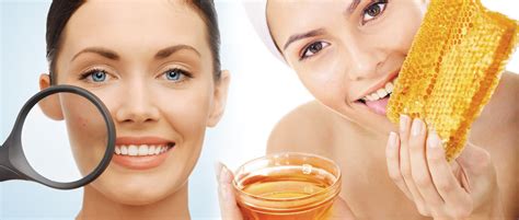 Ожог на лице от крема, что делать с химическим ожогом лица