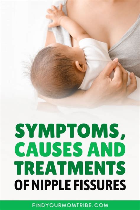 Symptoms Causes And Treatments Of Nipple Fissures Artofit