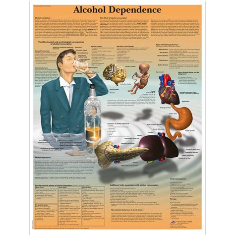 Alcohol Dependence Chart Sem Trainers