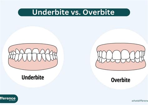 About Us Know Differences