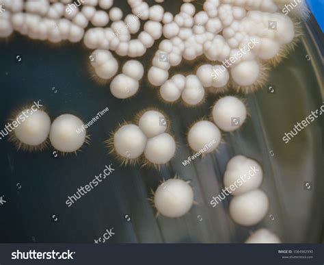 Candida Colony Morphology