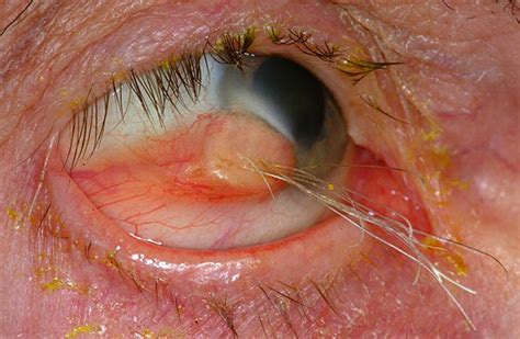 External Ophthalmic Photographs