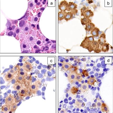 Two Examples Of Mast Cell Sarcoma Both Submission From The Eahp 2016 Download Scientific