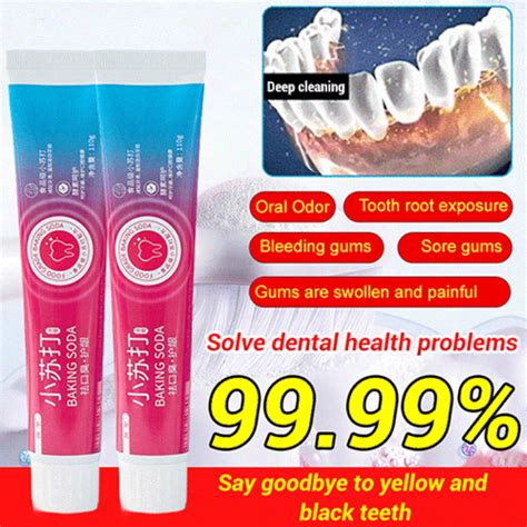 【oral Cavity Freshmothproof】baking Soda Toothpaste Oral Careprobiotic