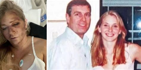 Prinz Andrew Seine Sex Klägerin Liegt Im Sterben Nau Ch