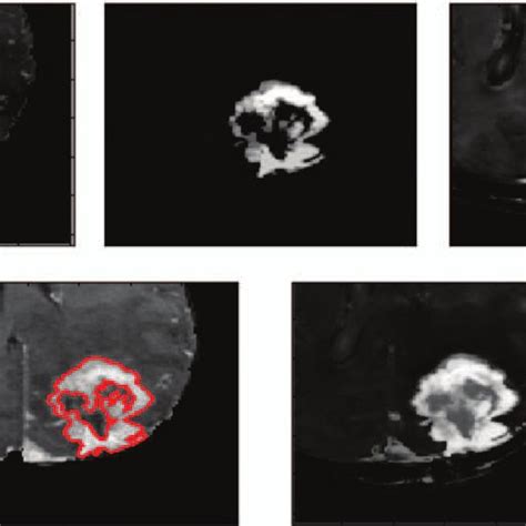 Examples Of Confidence Maps The First Row Shows Confidence Maps Of Gc Download Scientific