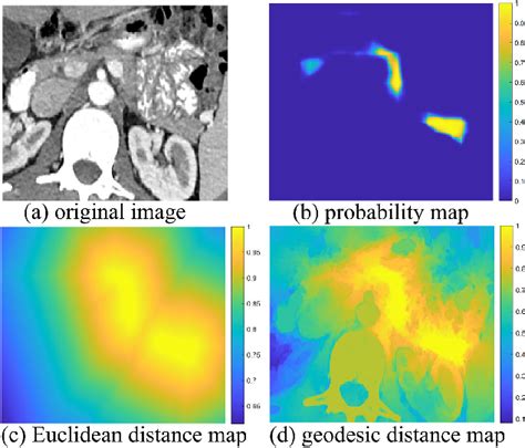 Figure 4 From Automatic Pancreas Segmentation In Ct Images With Distance Based Saliency Aware