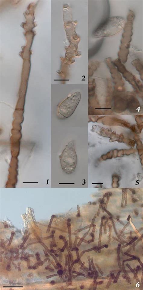 Pyricularia Contorta 1 Conidiophore 2 Conidiogenous Cell 3