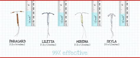 Paragard Vs Mirena Iud