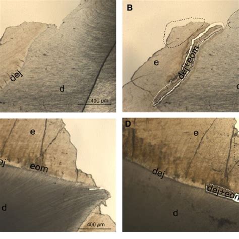Photographs Of Tooth Sections Obtained From A Laser Microdissection