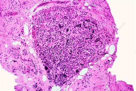 Carotid Body Light Micrograph Stock Image C0599839 Science Photo Library