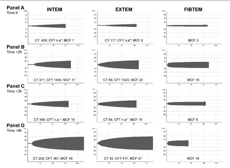 Figure 1 From Thromboelastometry Guided Therapy Of Massive