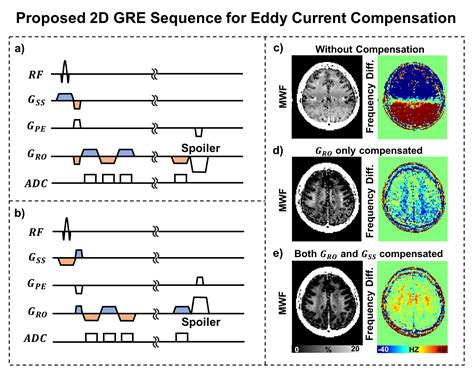 Figure 1 Multi Echo Gre Data Usingbipolar Readout Shows Large Phase