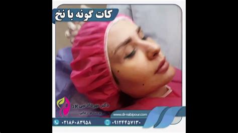 کات گونه با نخ Youtube