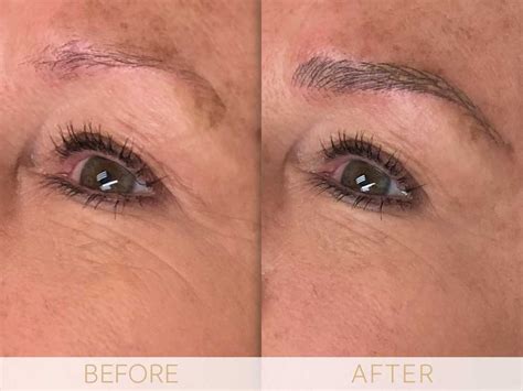 Microblading And Micropigmentation Acacia Skin Health And Beauty