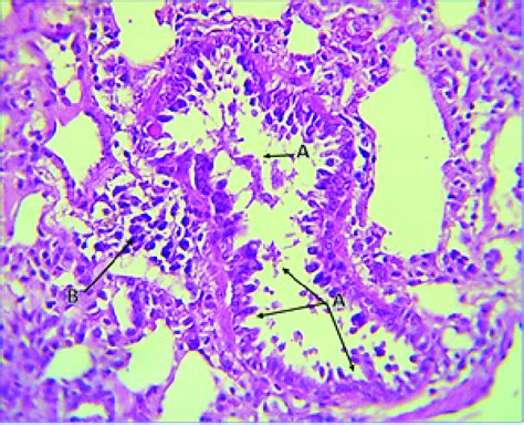 Lung Section Of A Rat From The Group Treated With Cadmium Chloride And